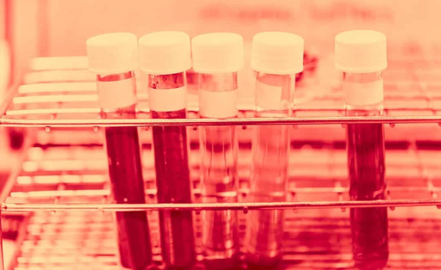 Testagen Peptide: Thyroid Research and Studies on Senescence ...